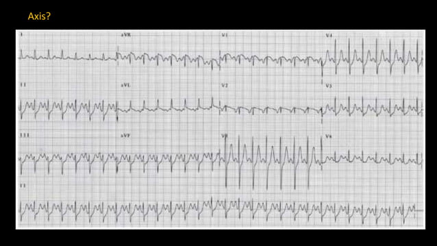 EKG part 1.pptx