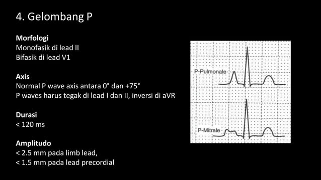 EKG part 1.pptx