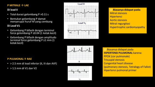 EKG part 1.pptx