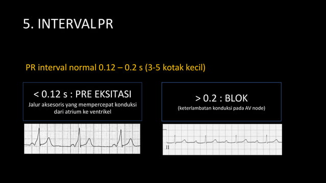 EKG part 1.pptx