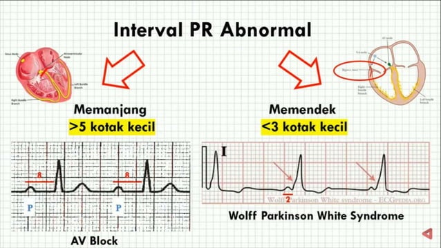 EKG part 1.pptx