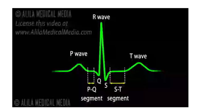 EKG part 1.pptx
