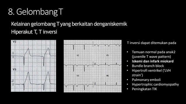 EKG part 1.pptx