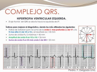 Ekg patológico | PPTX