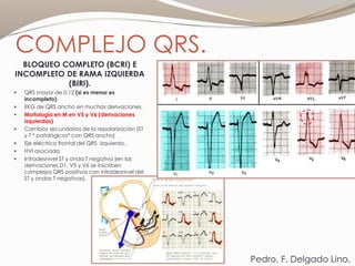 Ekg patológico | PPTX