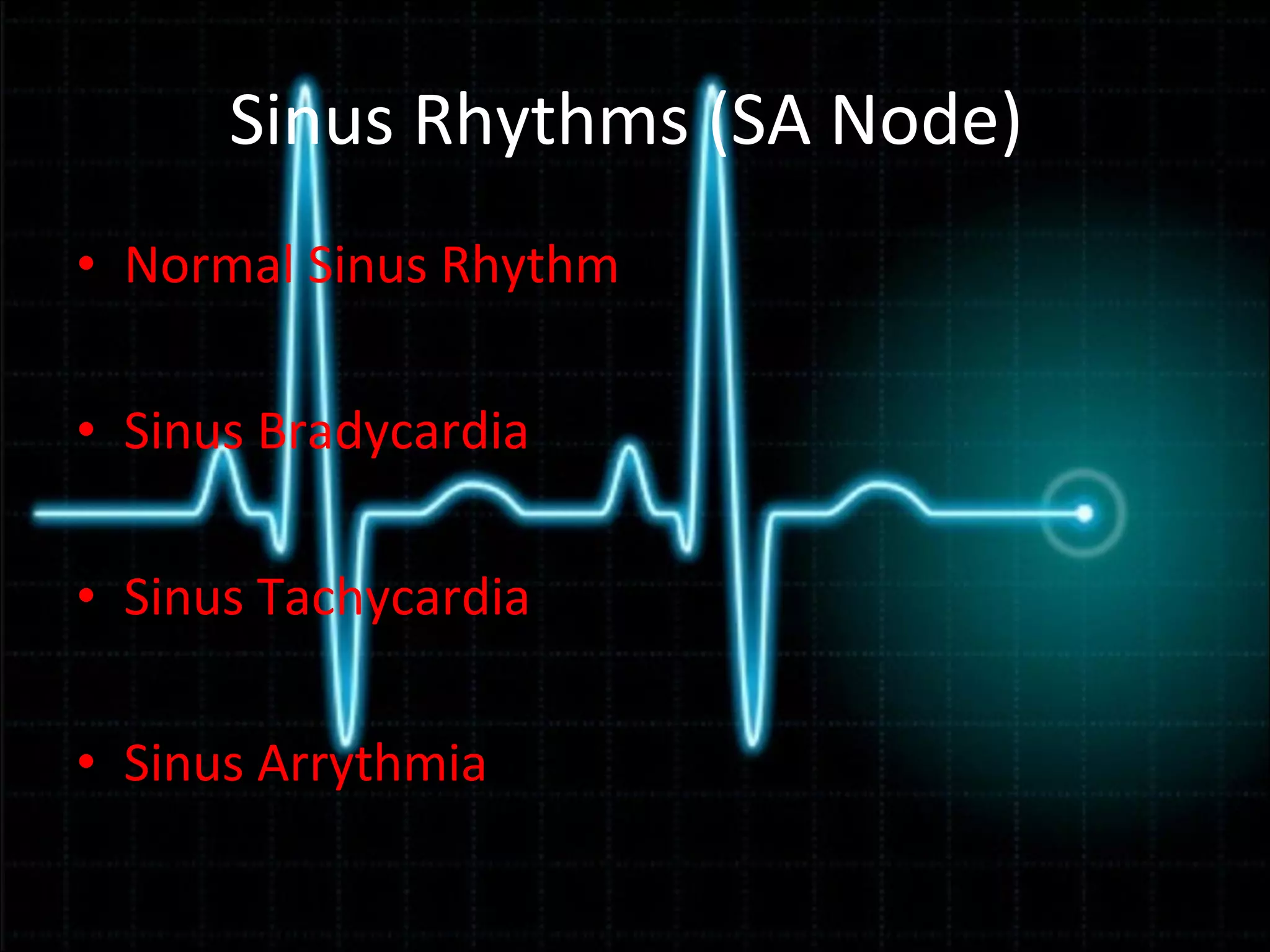 Ekg powerpoint | PPT