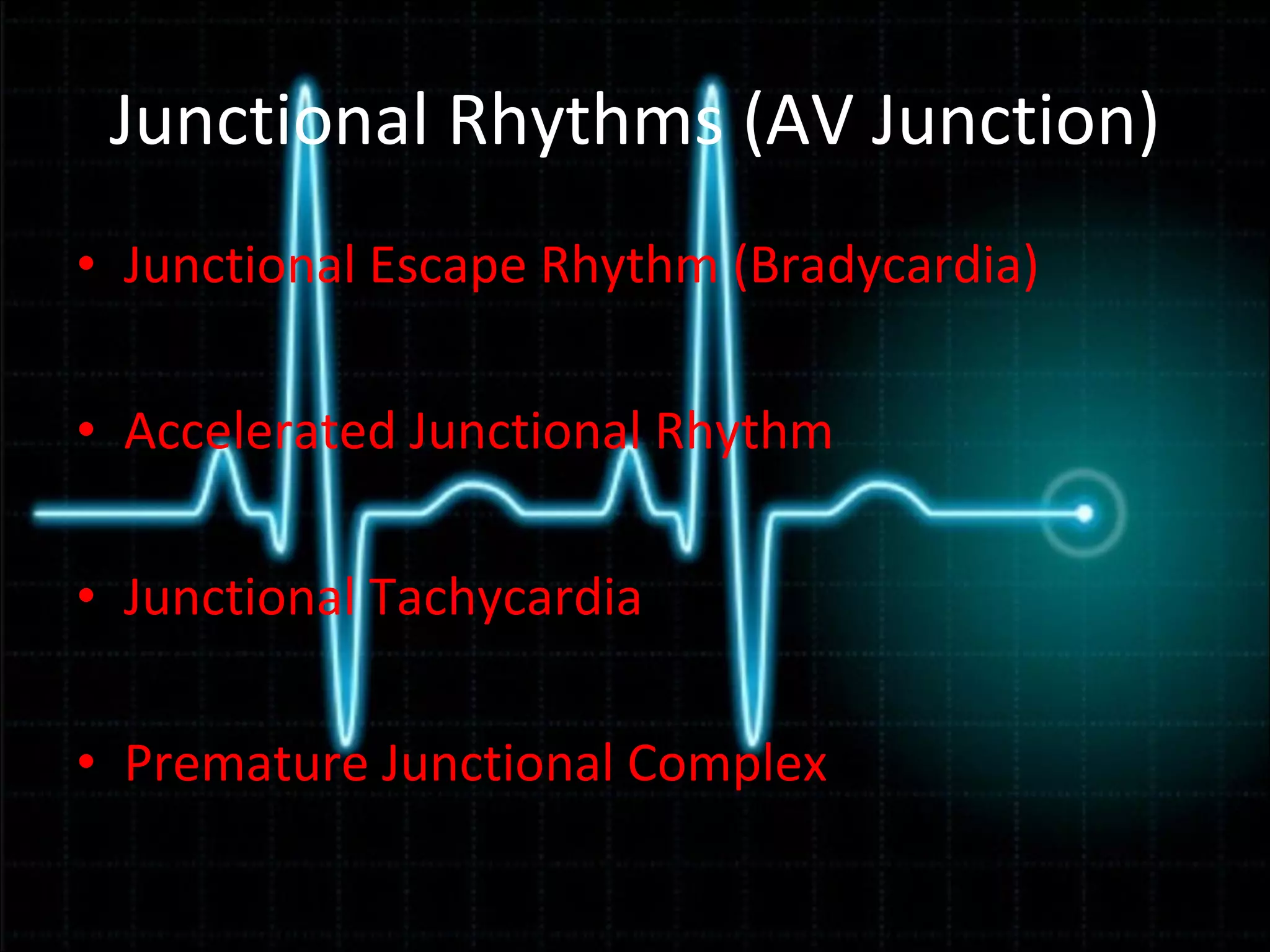Ekg powerpoint | PPT