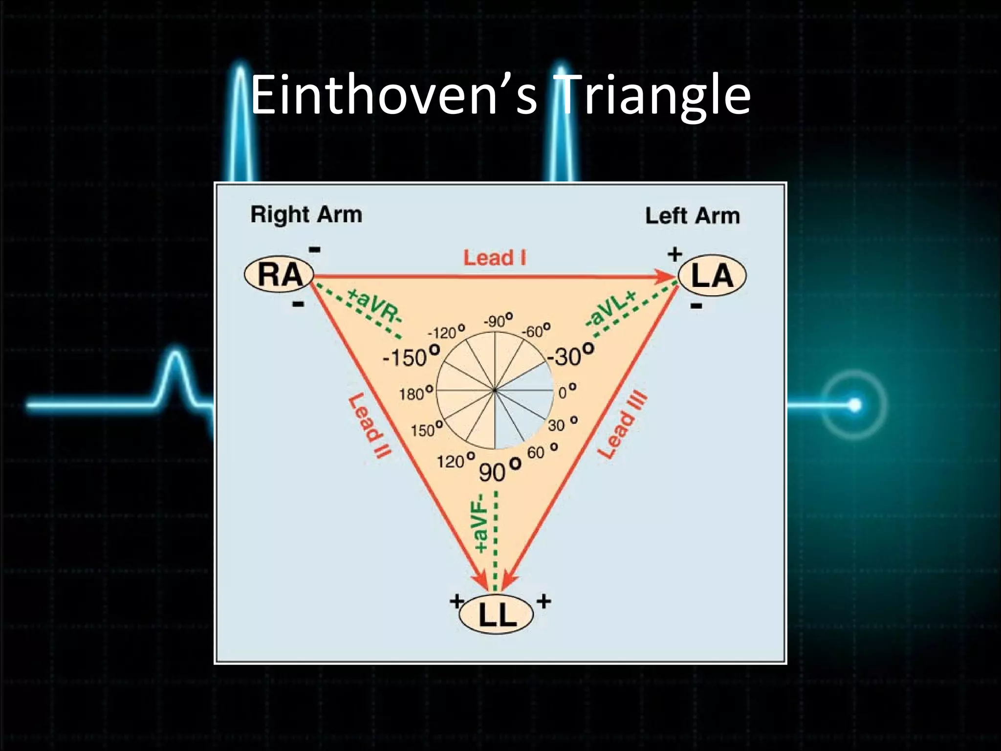 Ekg powerpoint | PPT