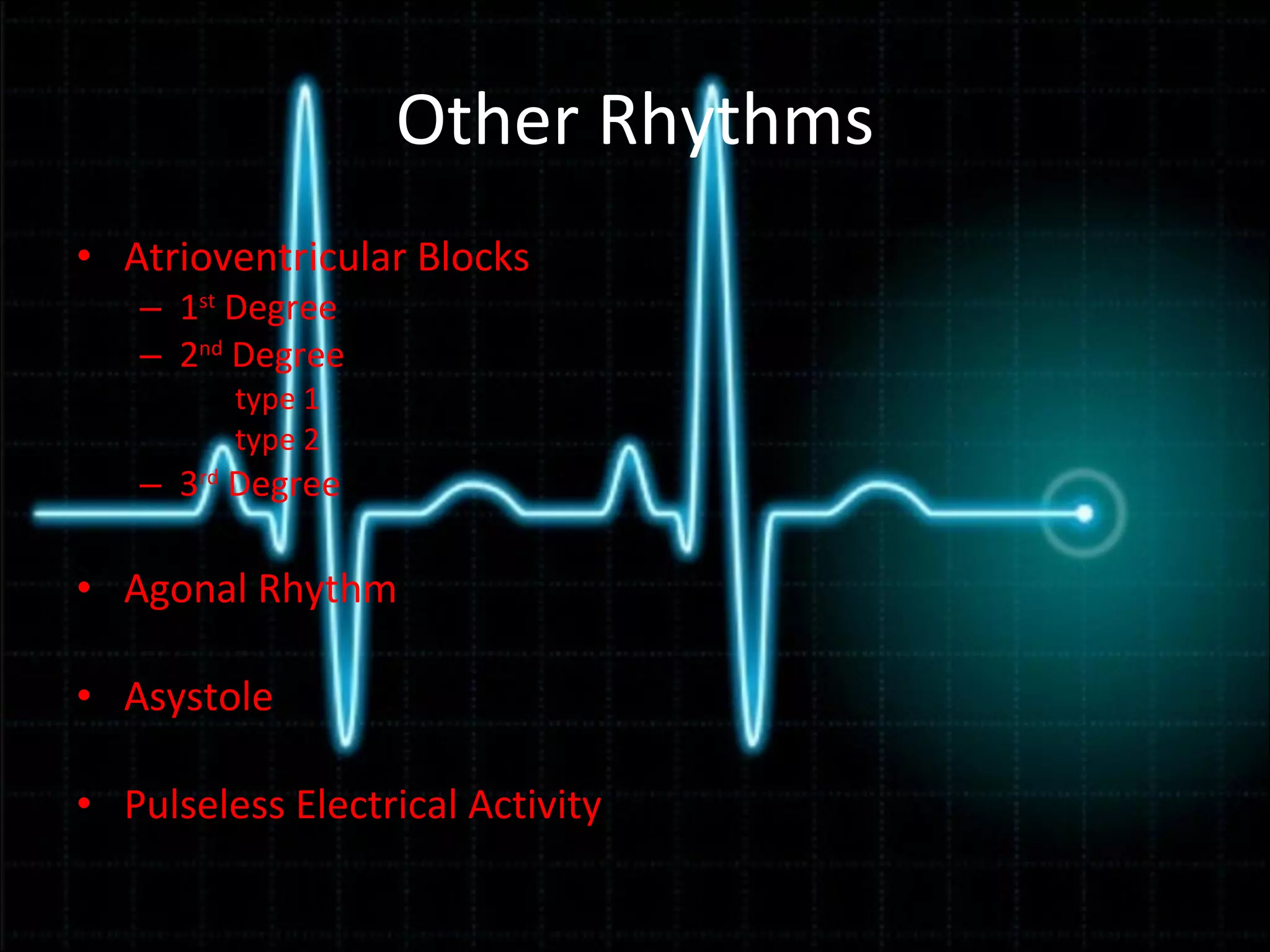 Ekg powerpoint | PPT