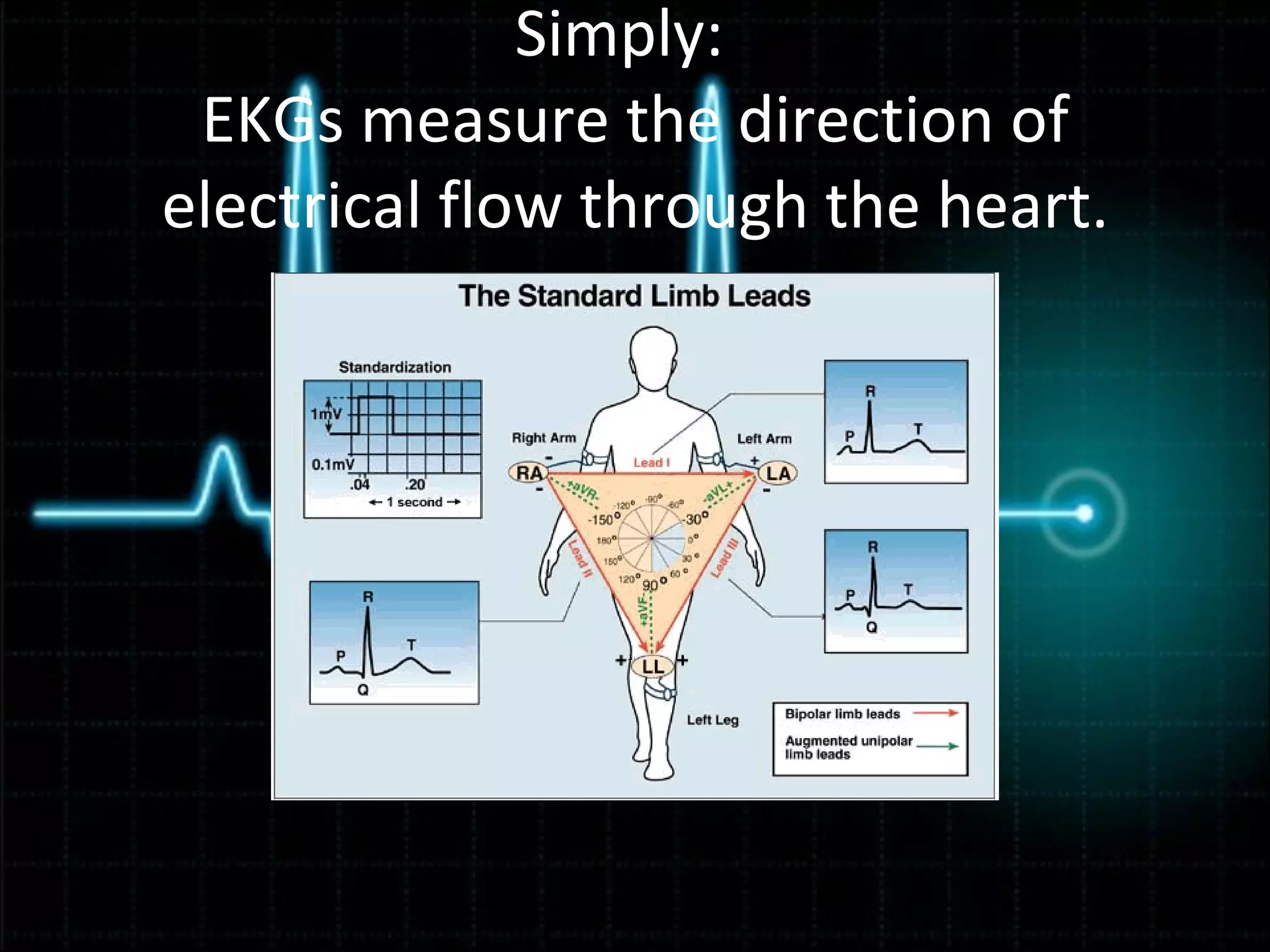 Ekg powerpoint | PPT