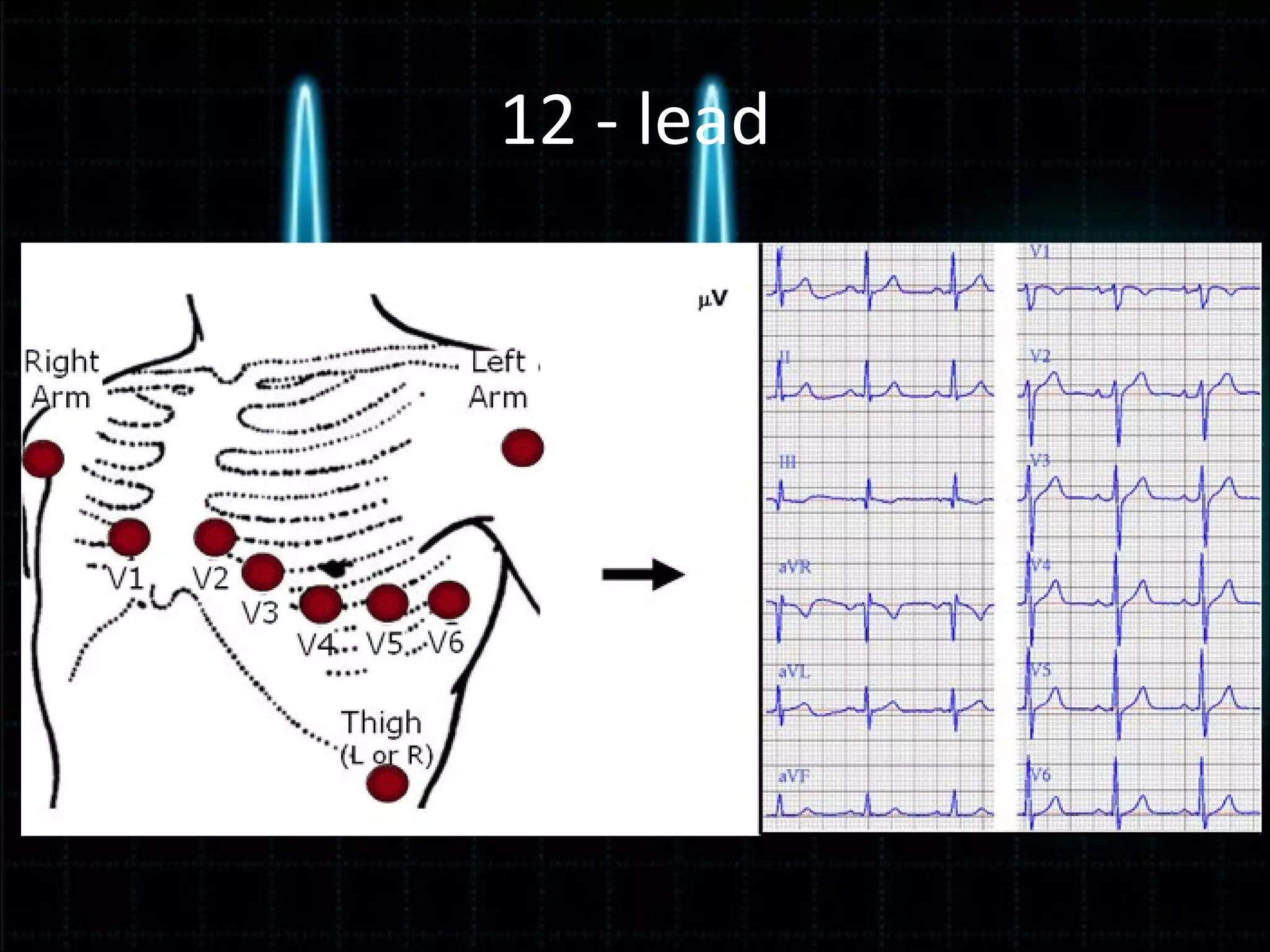 Ekg powerpoint | PPT