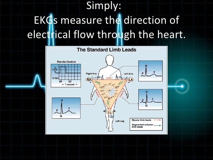 Ekg powerpoint