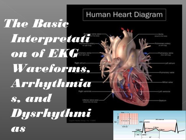 Ekg presentation | PPT