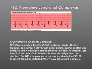 Ekg presentation | PPT