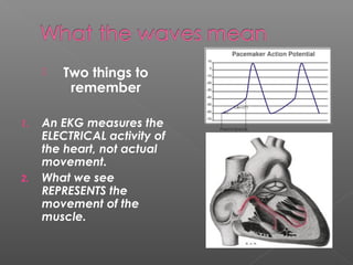 Ekg presentation | PPT