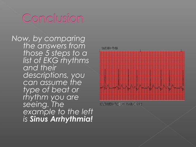 Ekg presentation | PPT