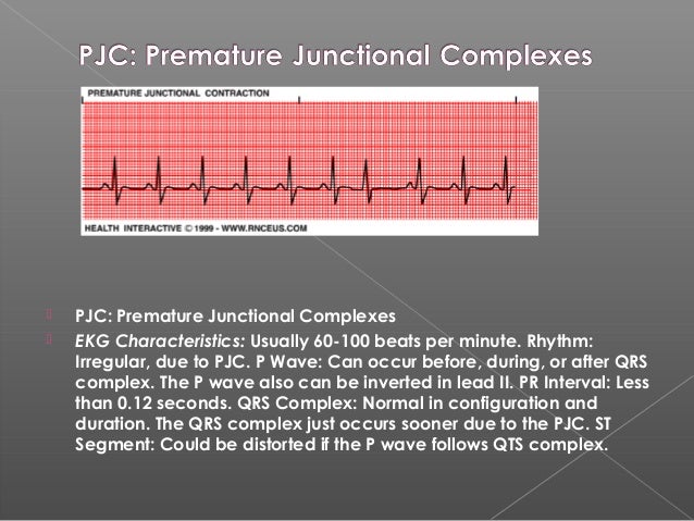 Ekg presentation