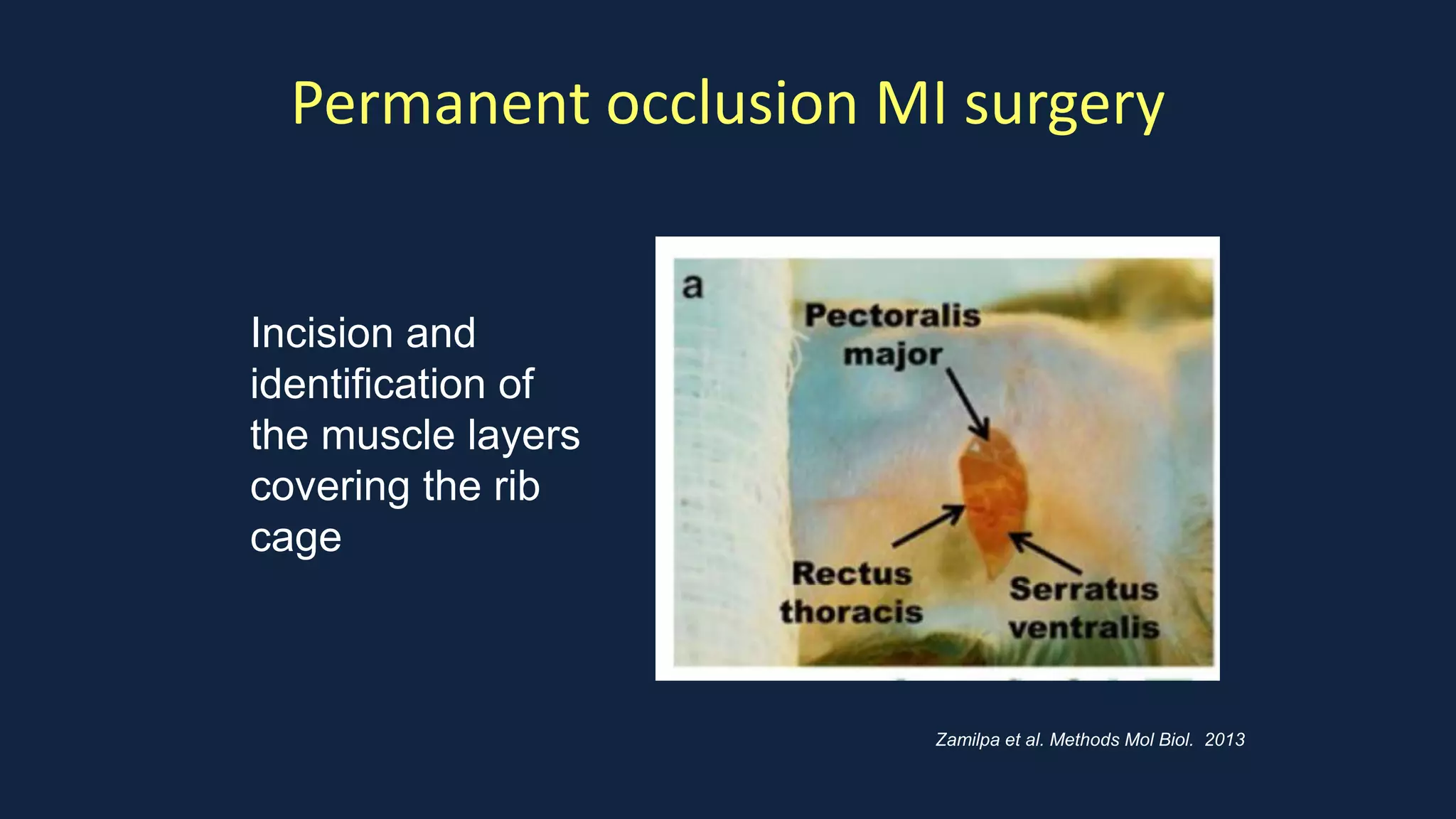 Using EKG to Confirm MI in Mouse Model of Permanent LAD Occlusion | PPTX