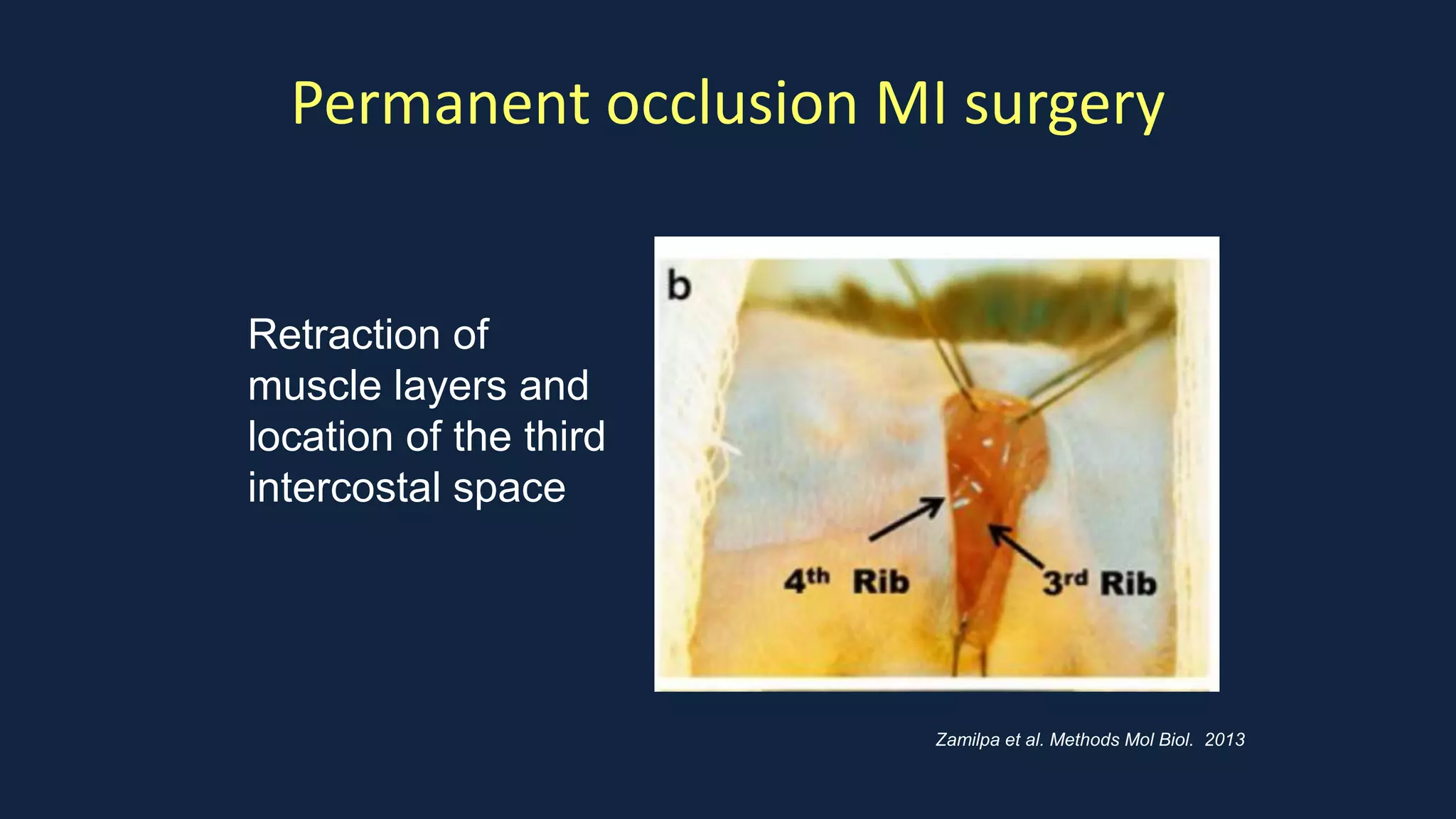Using EKG to Confirm MI in Mouse Model of Permanent LAD Occlusion | PPTX