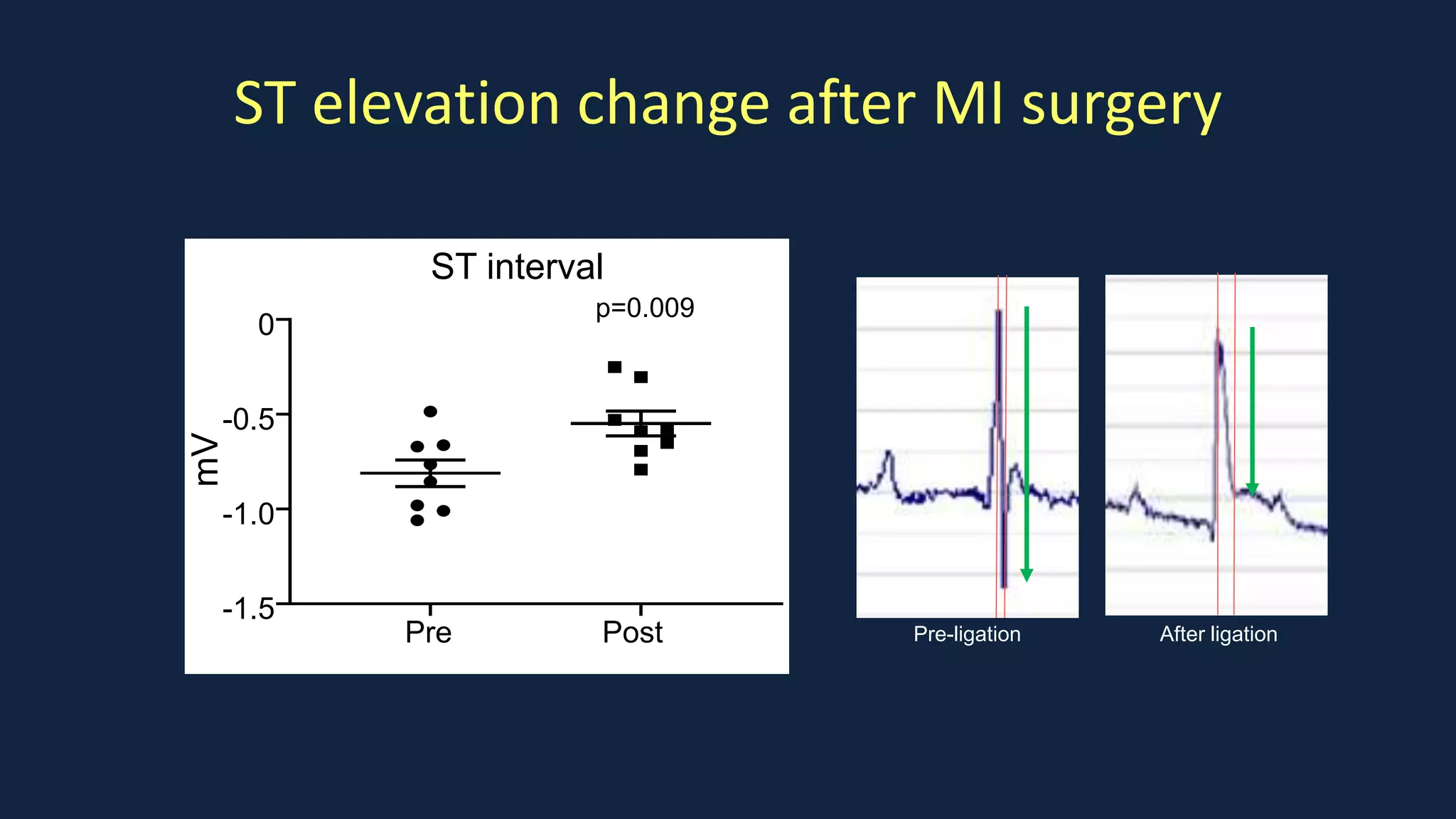 Using EKG to Confirm MI in Mouse Model of Permanent LAD Occlusion | PPTX