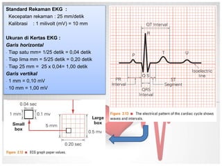 EKG REFERAT ELISA.ppt