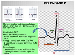 EKG REFERAT ELISA.ppt