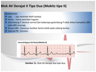 EKG REFERAT ELISA.ppt