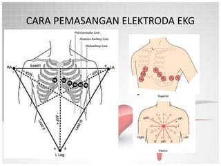 EKG REFERAT ELISA.ppt