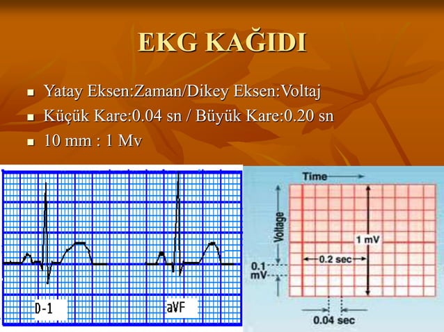 Ekg, ritim ve pace maker | PPT