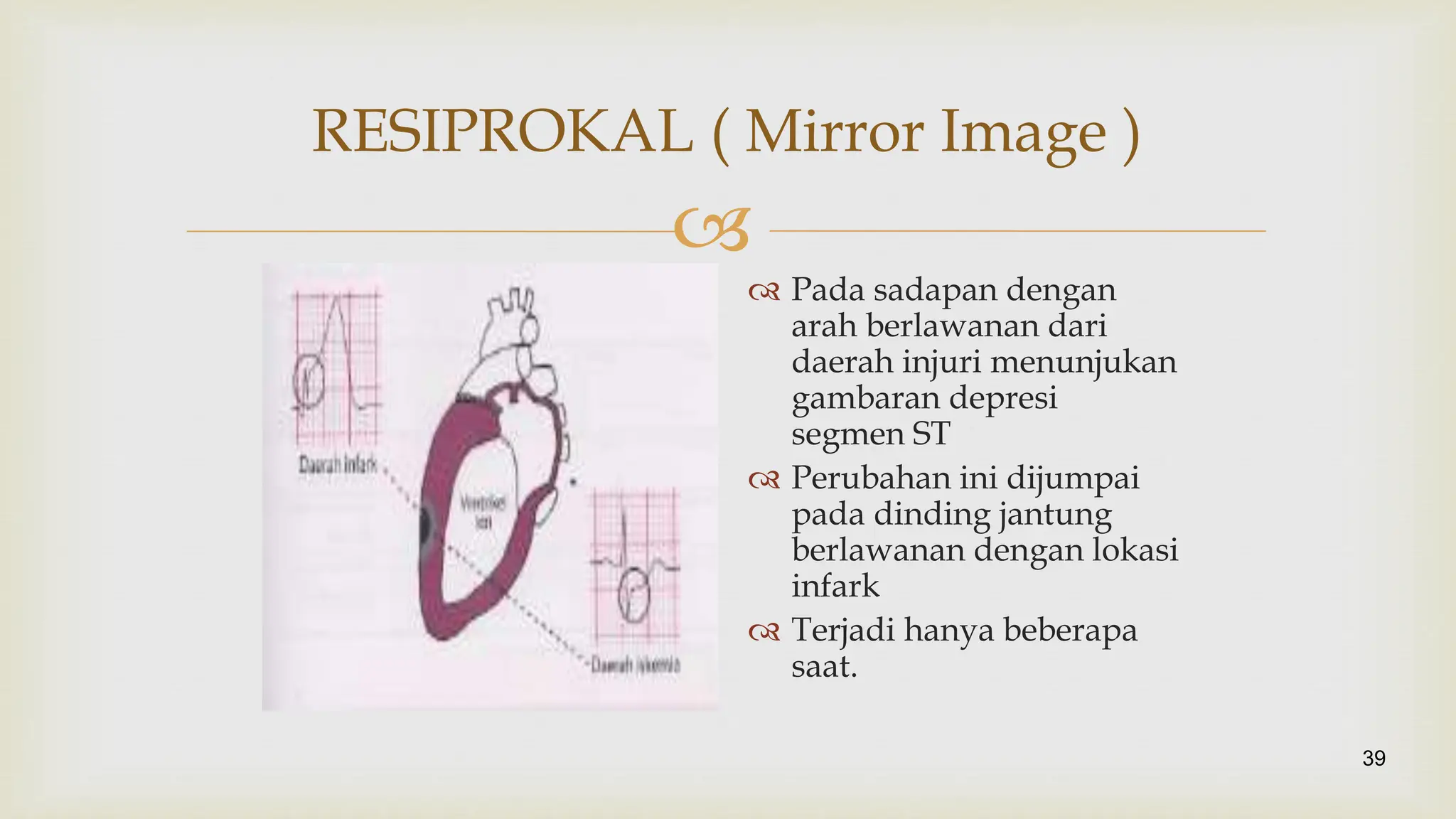 EKG Pada Sindroma koroner akut di UGD.pptx