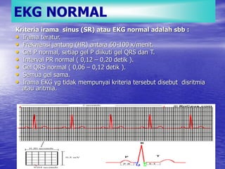 EKG SKILL 119.pdfghjjkkkkkkkkkkkkkkkkkkkkkkk | PDF