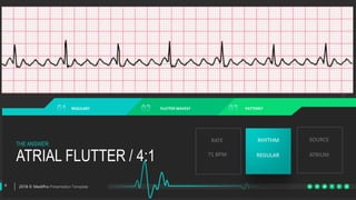 Ekgskillspractice atrial arrhythmias | PPT
