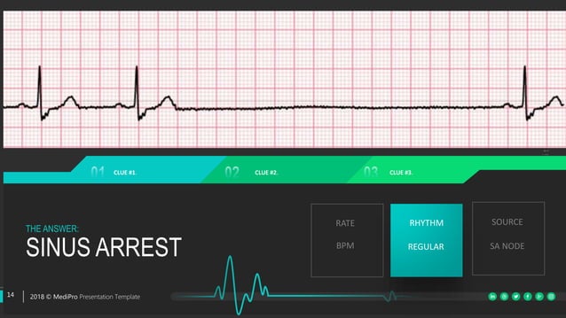Ekgskillspractice atypical conduction | PPT