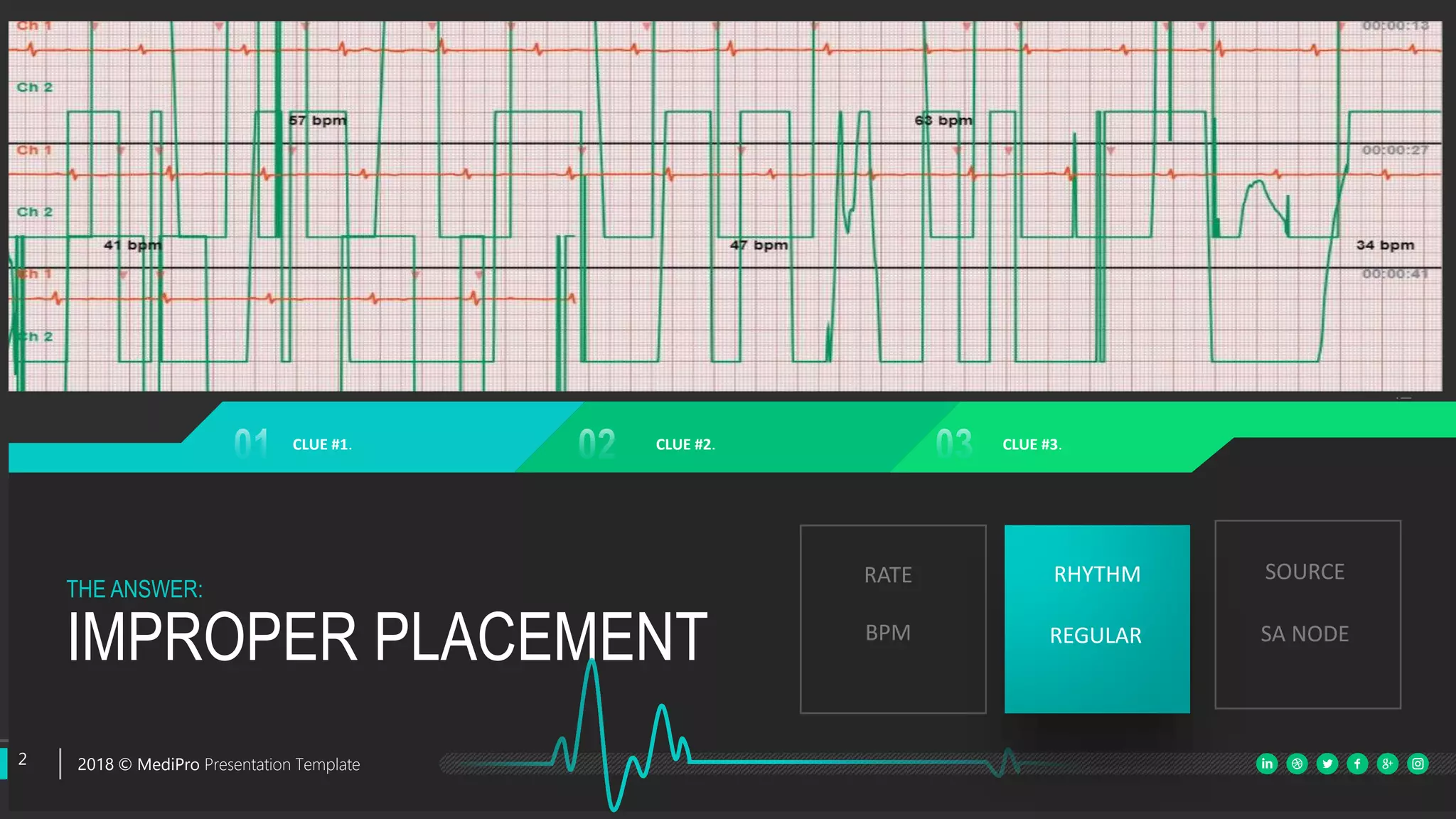 Ekgskillspractice lead placement errors | PPTX