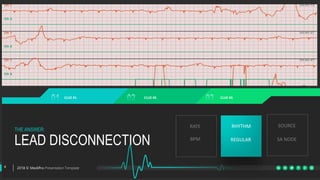 Ekgskillspractice lead placement errors | PPTX