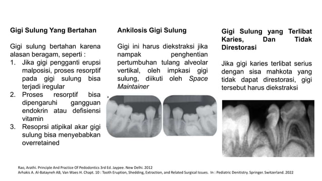 EKSTRAKSI GIGI SULUNG.pptx