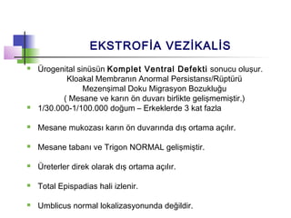 Ekstrofi̇ epi̇spadi̇as-hi̇pospadi̇as-kordi̇ | PPT