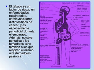 El Tabaco | PPS