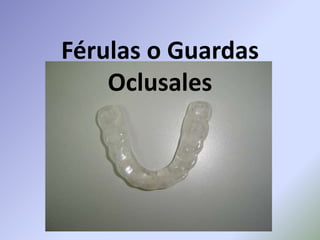 Elaboracion de Ferulas Ortoestáticas | PPTX