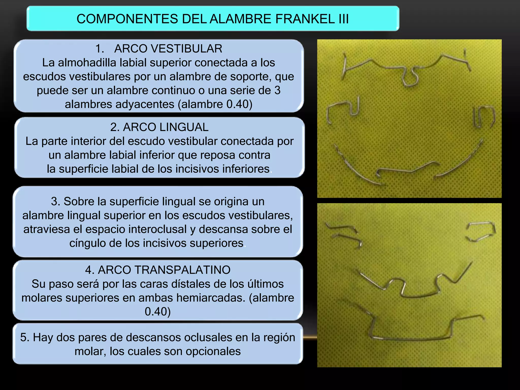 ELABORACIÓN DE APARATO FRANKEL III | PPSX