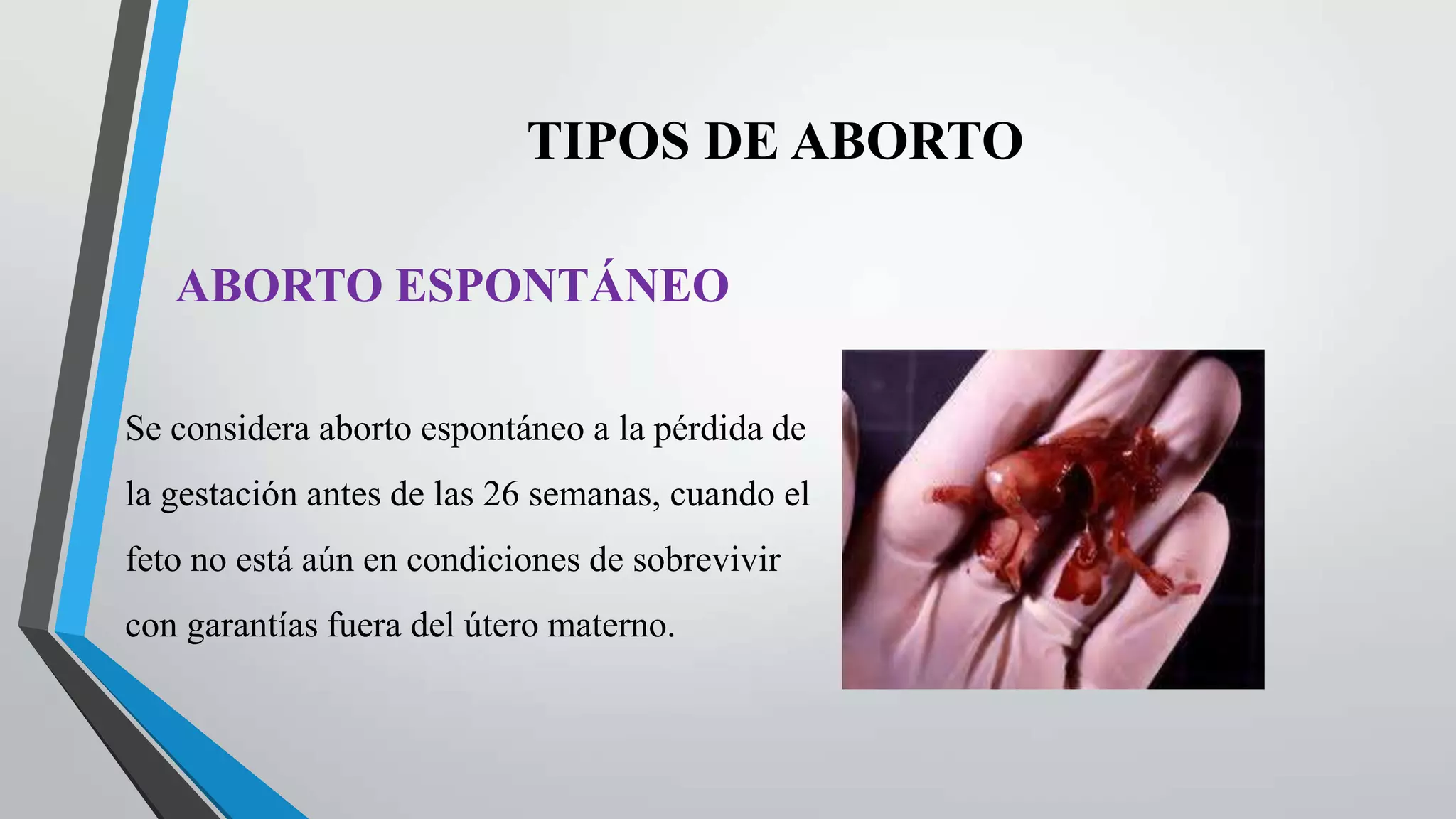 El aborto | PPTX