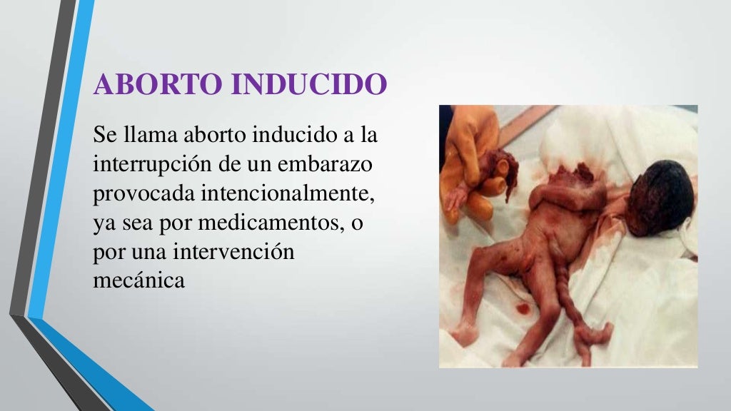 El aborto