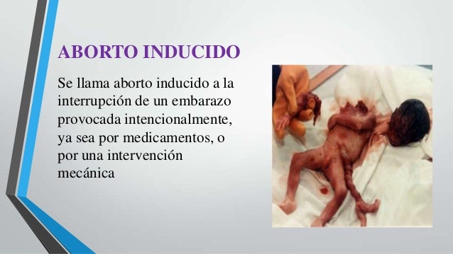 El aborto