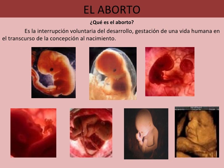 El aborto (presentación diapositivas)