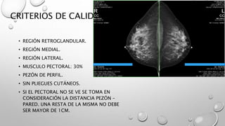 El arte de la mastografia en el diagnostico | PPTX