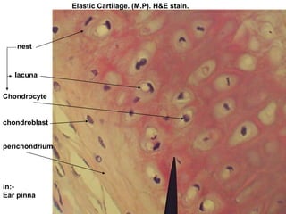 elastic cartilage.ppt
