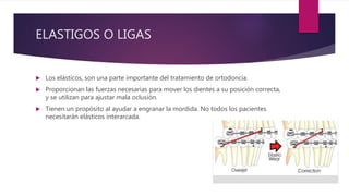 ELASTICOS EN ORTODONCIA.pptx