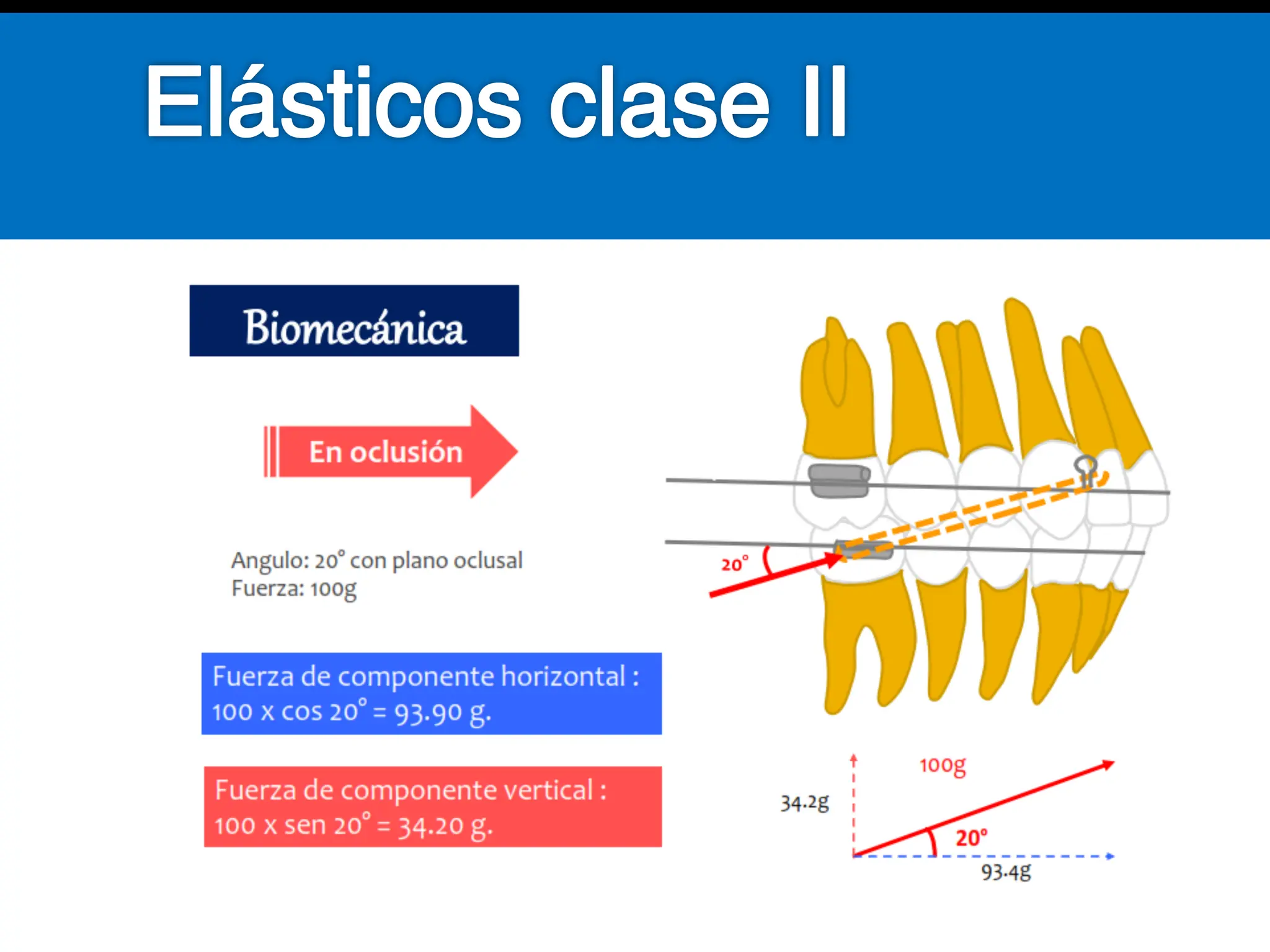 Elásticos Intermaxilares.pdf