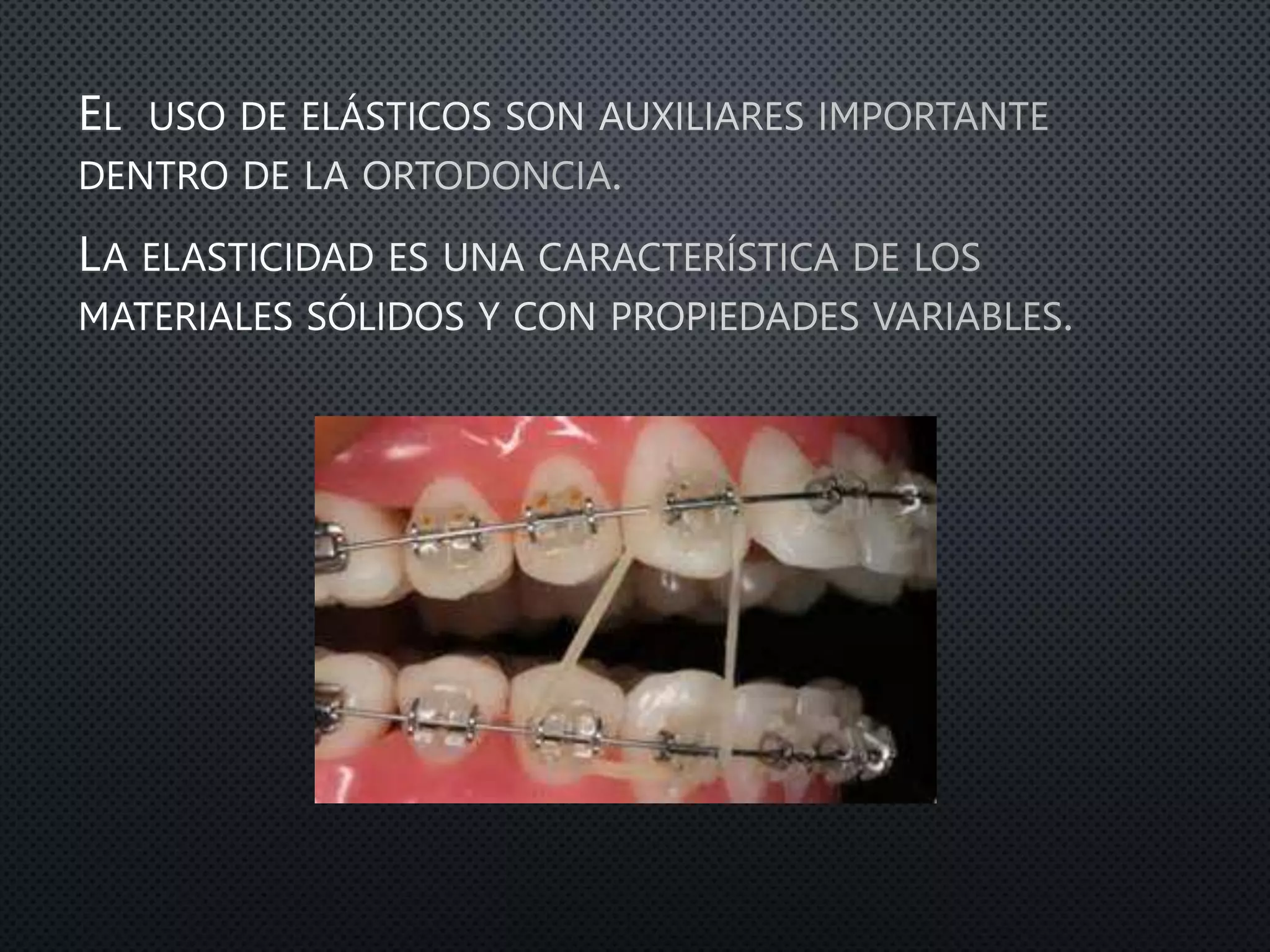 ELASTICOS INTERMAXILARES.pptx
