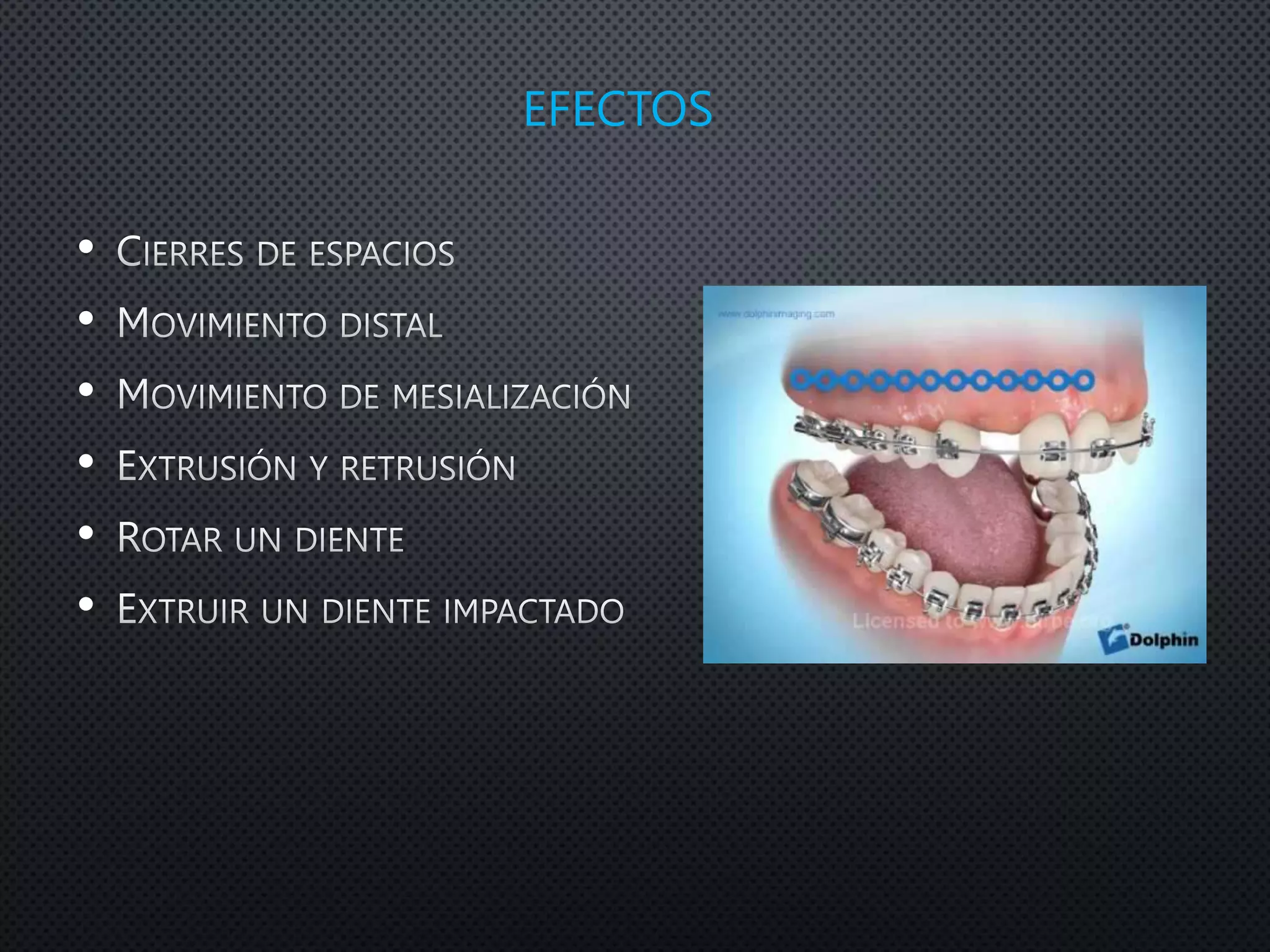 ELASTICOS INTERMAXILARES.pptx